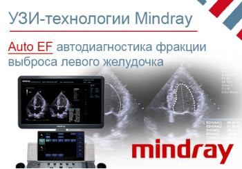 Auto EF от Mindray в узи сканерах Resona