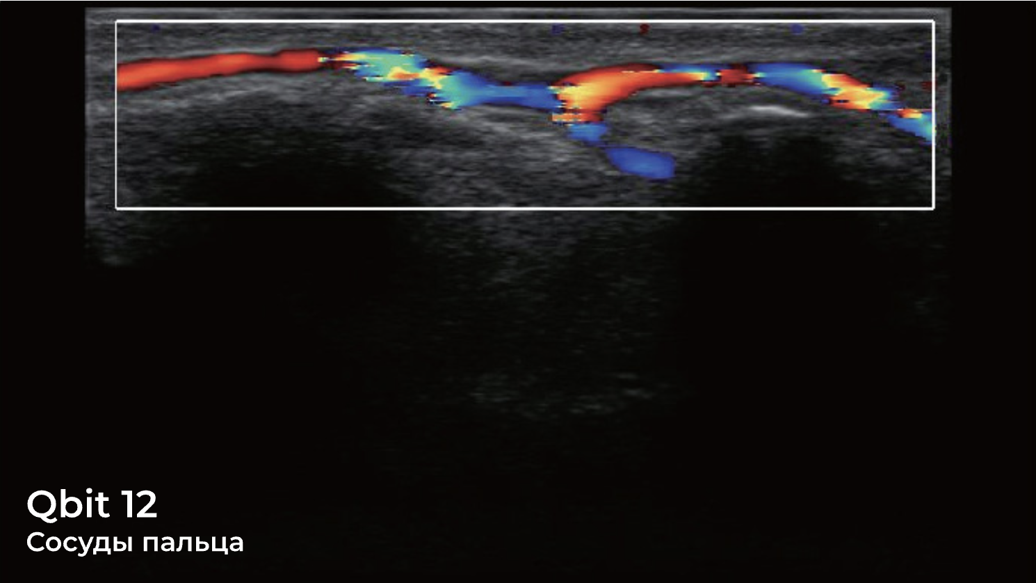 Купить УЗИ аппарат Chison Qbit 12 (XBit 90) New Matrix по низкой цене у официального поставщика ...
