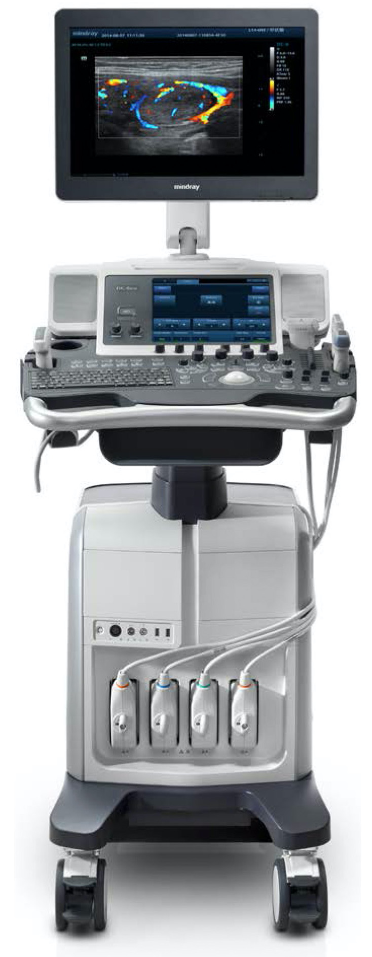 Сравнение УЗИ аппаратов Mindray DC-8 и Mindray DC-8 Exp
